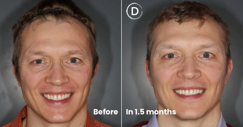 Sofwave - Dermatology Circle NYC